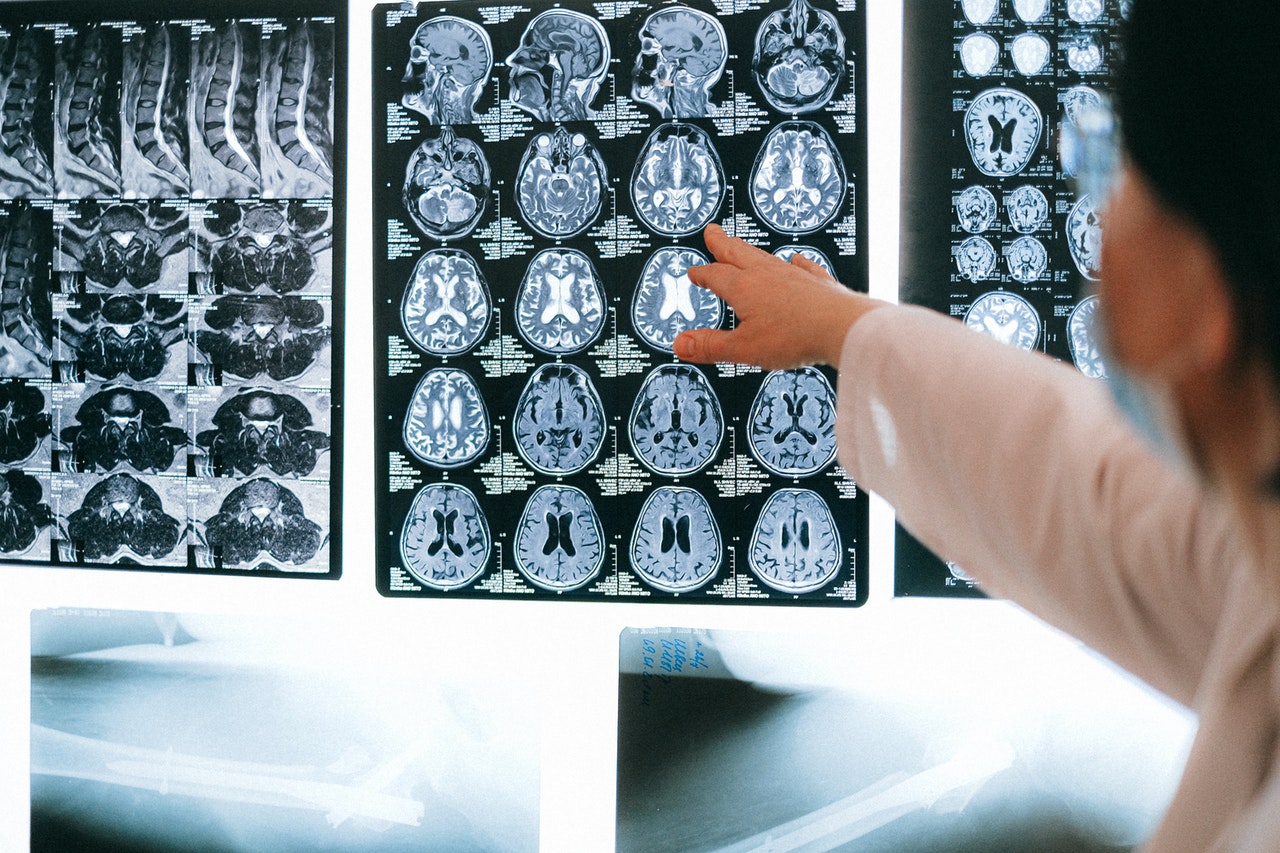 Doing A PhD In Neuroscience DiscoverPhDs Doing A PhD In Neuroscience DiscoverPhDs